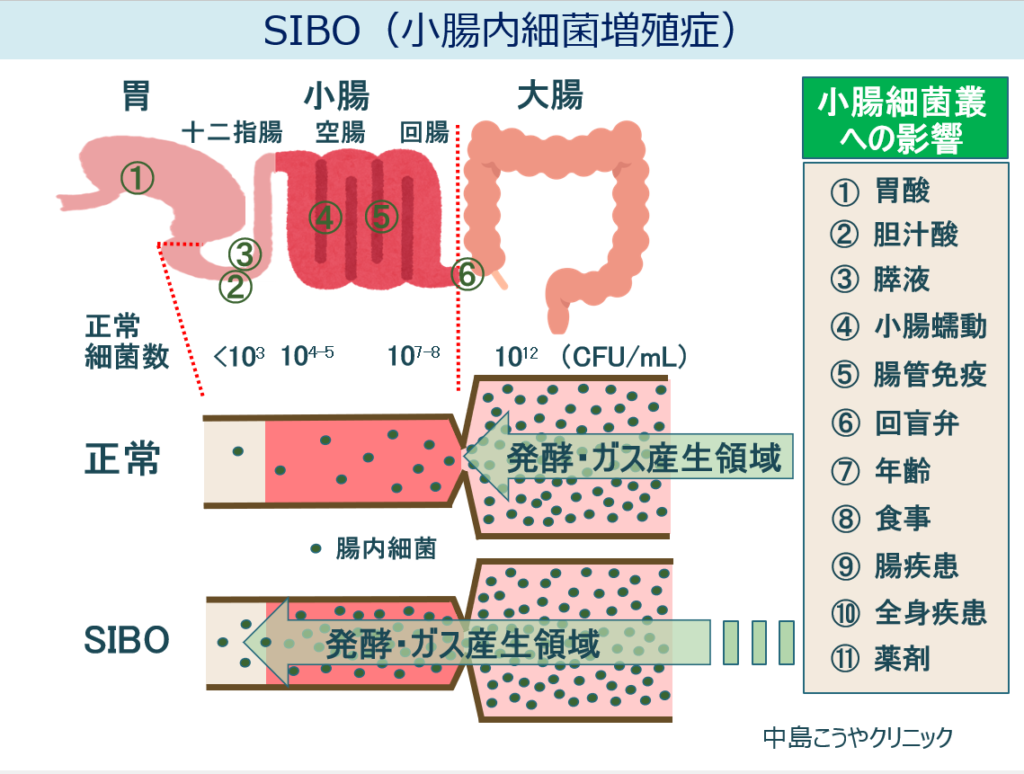 SIBO（小腸内細菌増殖症）とは | 中島こうやクリニック（内科、胃腸科、呼吸器科、循環器科、アンチエイジング、男性更年期、女性更年期）那珂川市、春日市、福岡市（nkoya.jp）